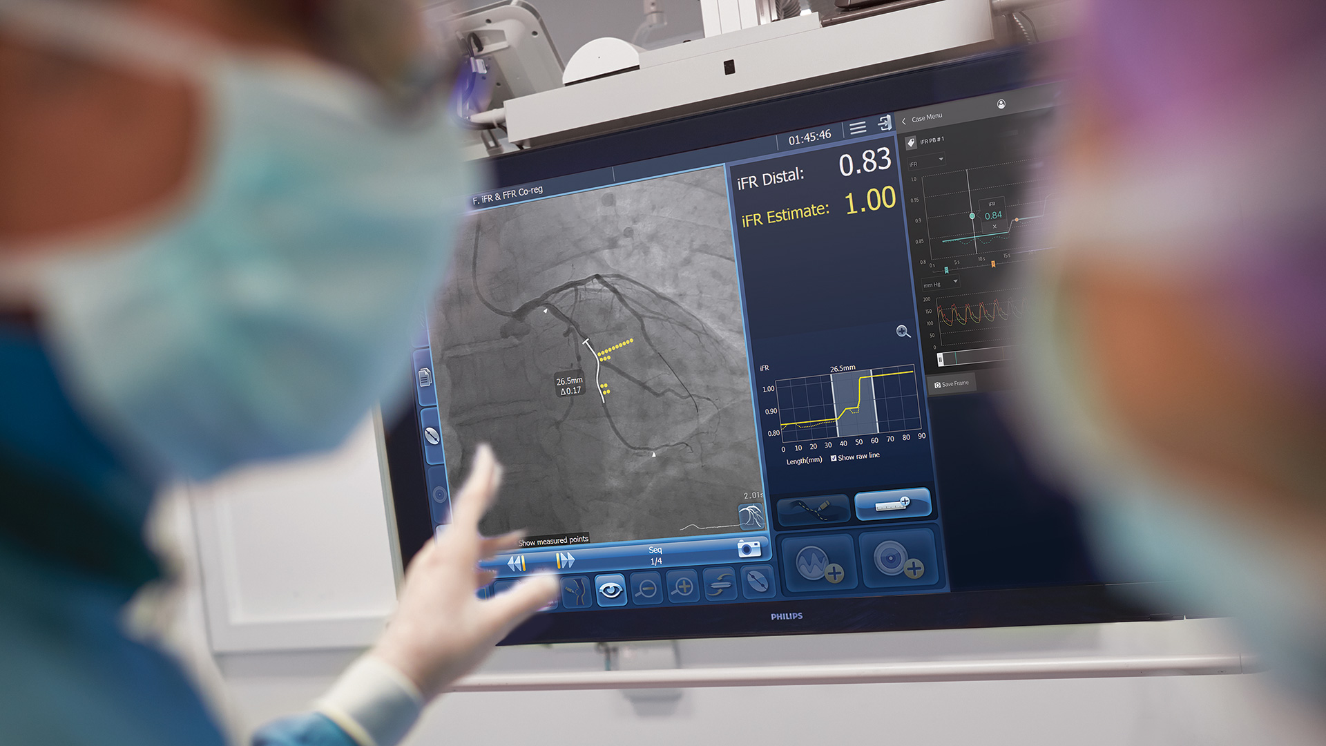 Spectranetics | Philips